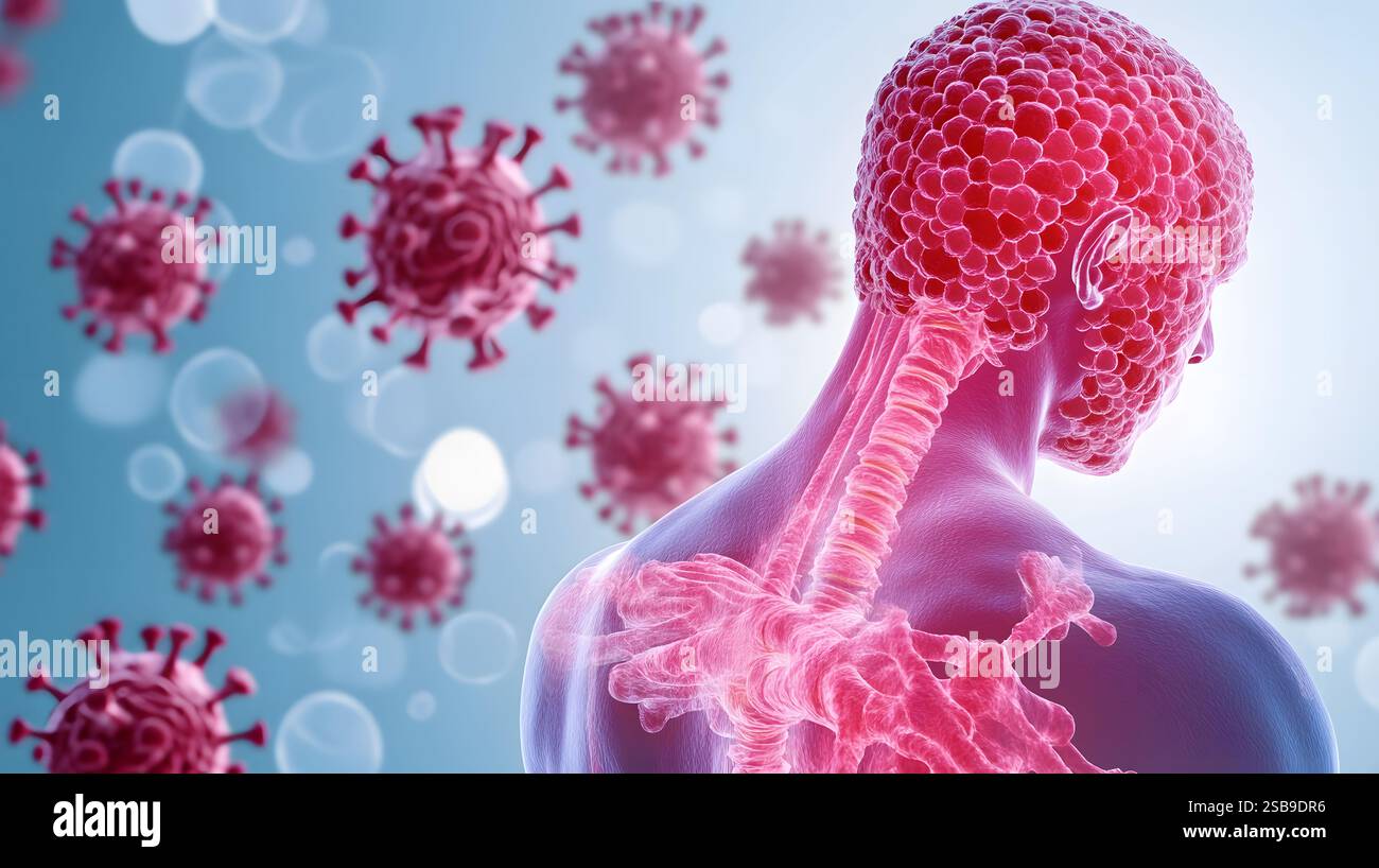 Detailed medical depicting the herpes zoster virus affecting the nerve ...