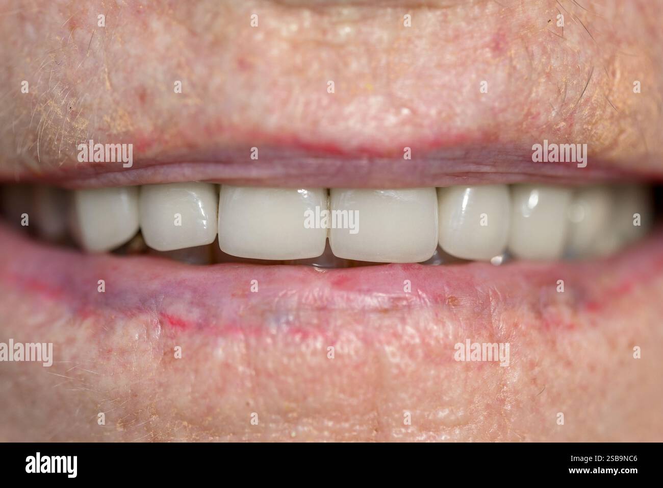 A detailed close-up of an older person's smile, focusing on the teeth ...
