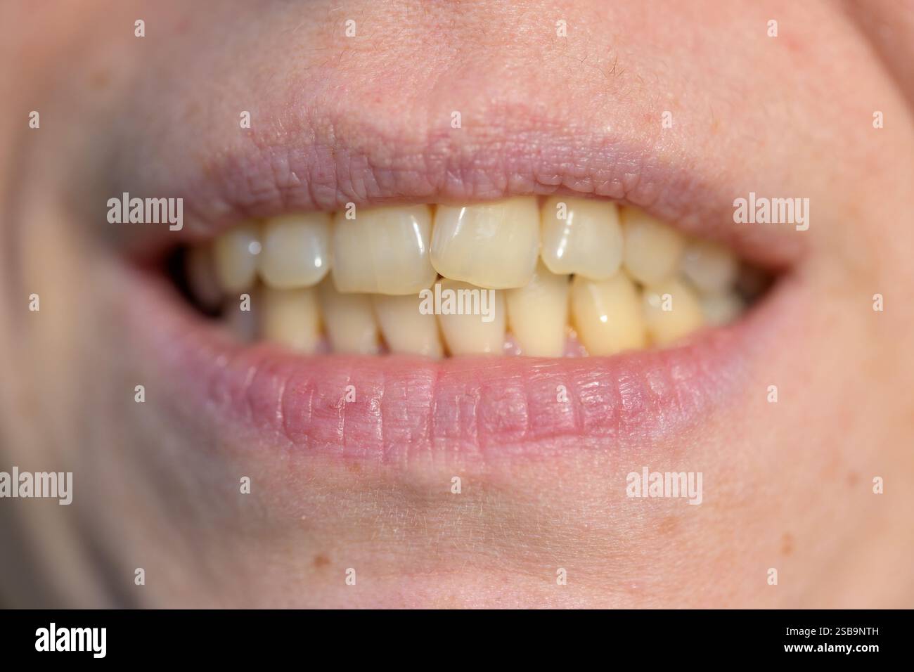 A detailed macro photograph capturing a natural smile, focusing on the ...