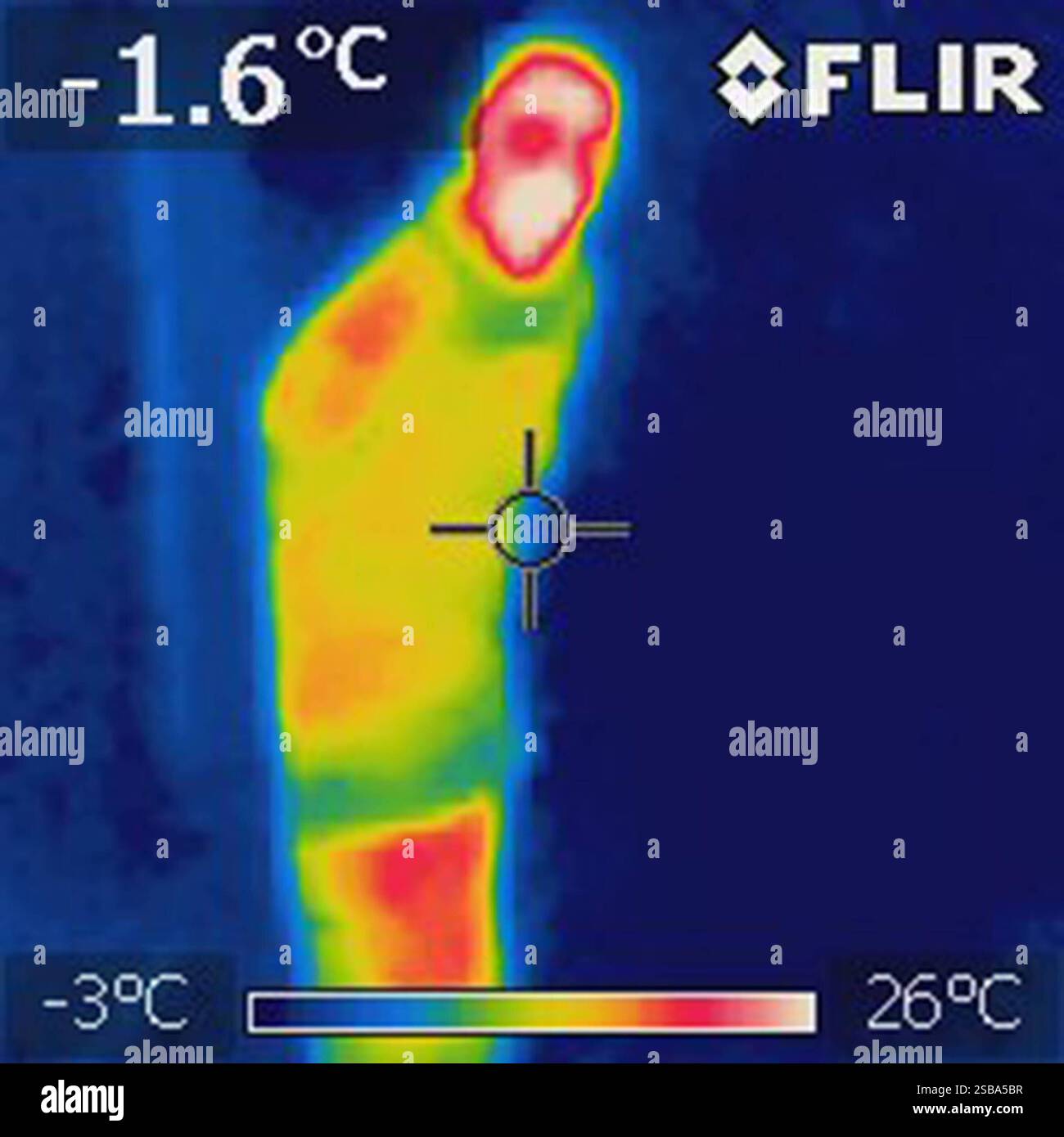 Thermografie am menschlichen Körper Energetische Schwachstellen mit der ...