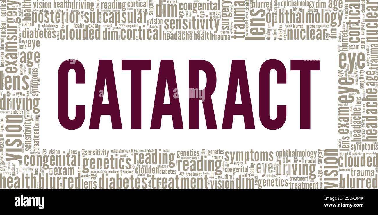 Cataract word cloud conceptual design isolated on white background ...