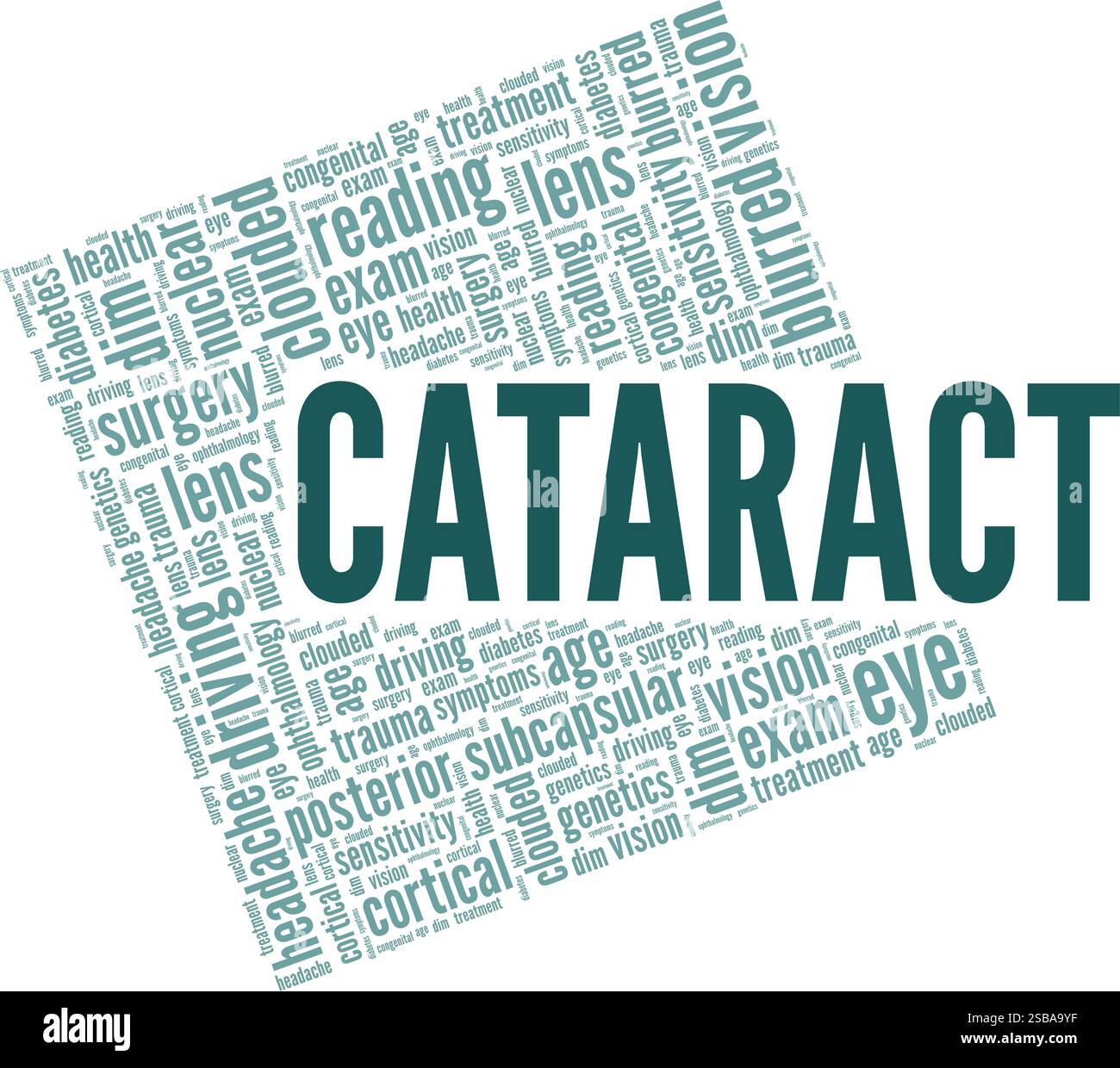 Cataract word cloud conceptual design isolated on white background ...