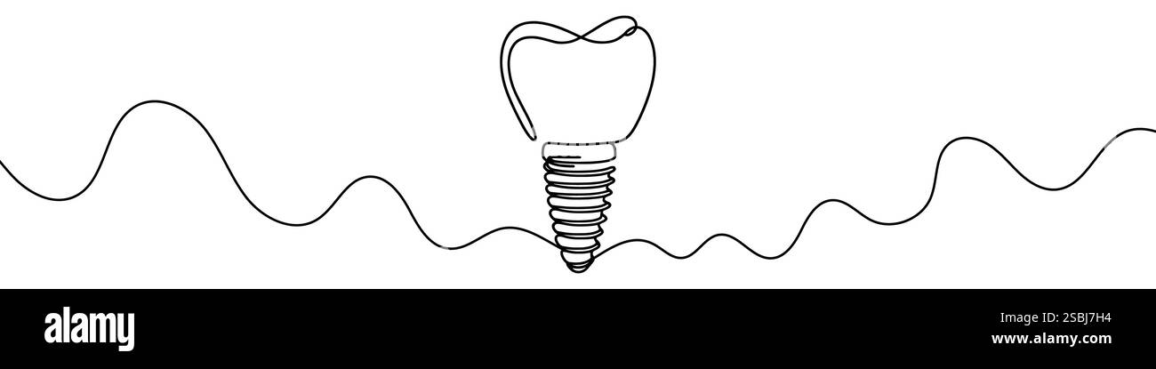 One continuous line illustration of a dental implant, isolated on white ...