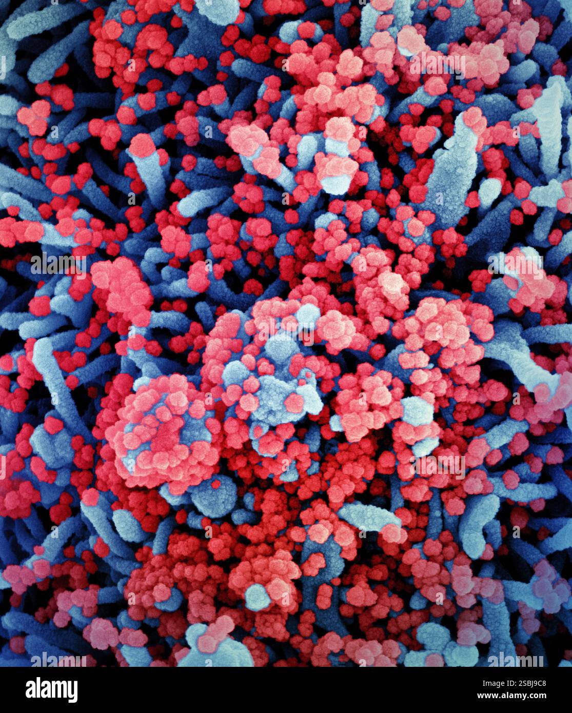 Colorized scanning electron micrograph of a cell (blue) heavily ...
