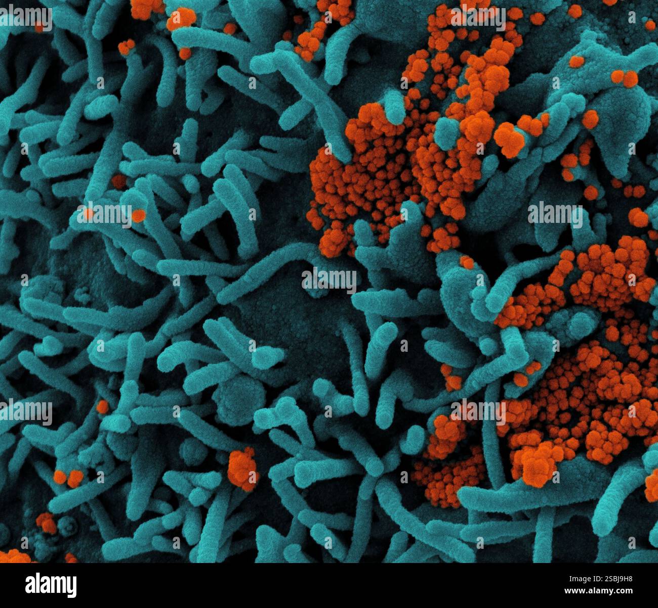 Colorized scanning electron micrograph of a cell (teal) infected with ...