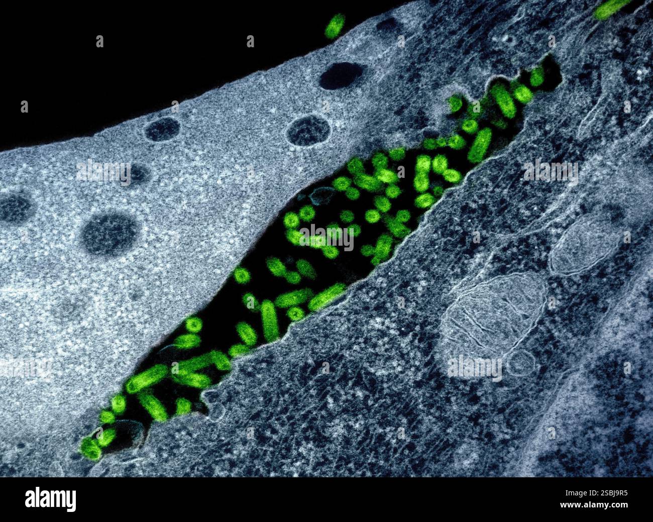 Transmission electron micrograph of vesicular stomatitis virus (VSV ...