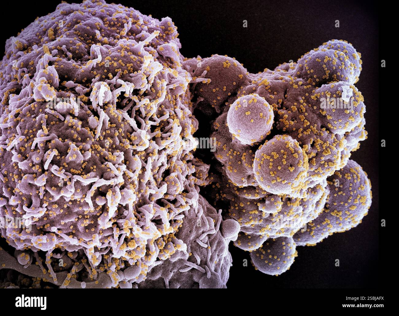 Colorized scanning electron micrograph of a cell (pink) infected with ...
