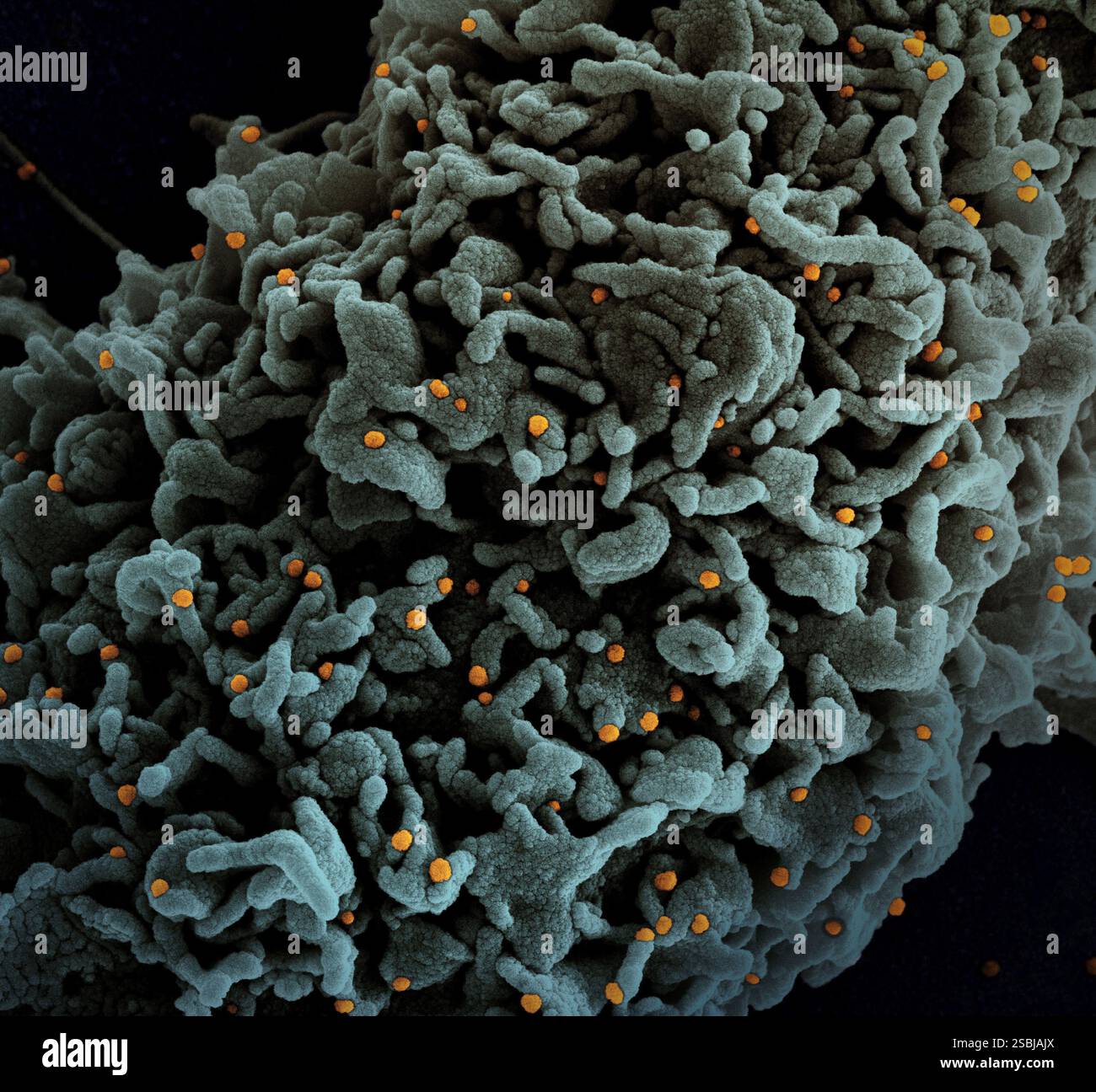 Colorized scanning electron micrograph of a cell (blue-grey) infected ...