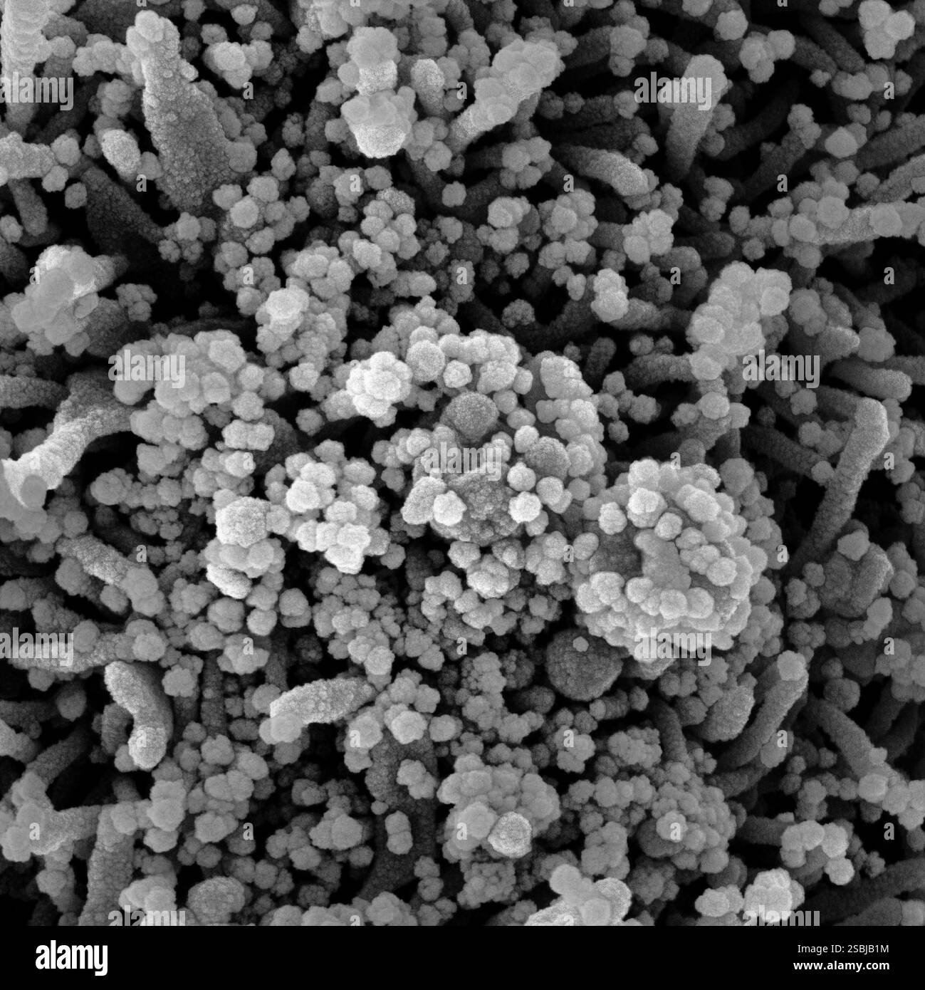 Scanning electron micrograph of a cell heavily infected with SARS-CoV-2 ...