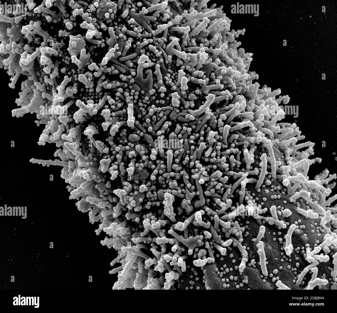 A single elongated CCL-81 cell heavily infected with SARS-CoV-2 virus ...