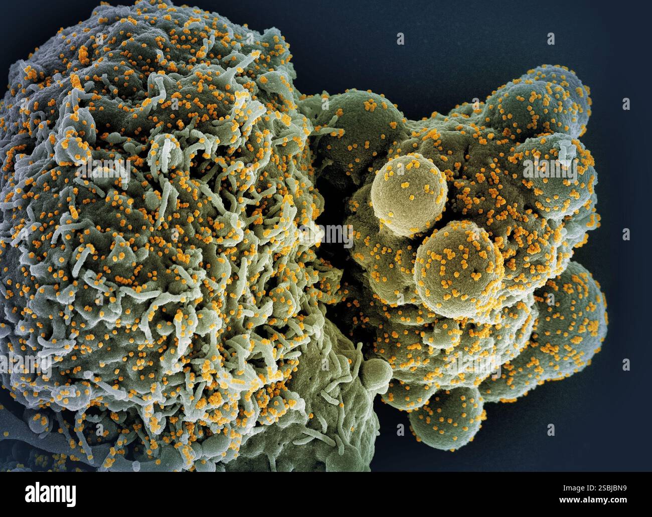Colorized scanning electron micrograph of a cell (green) infected with ...