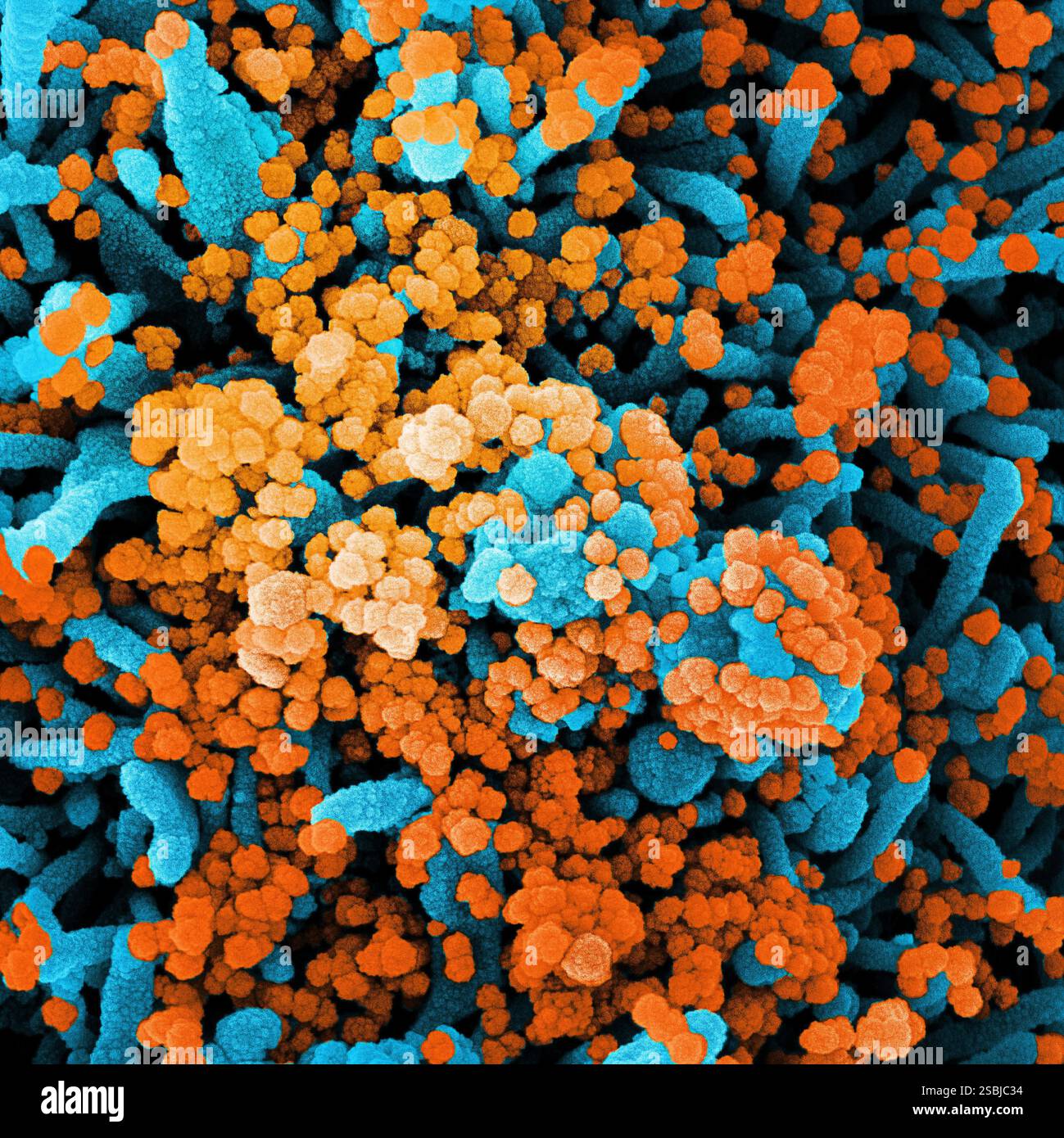 Scanning electron micrograph of a cell heavily infected with SARS-CoV-2 ...