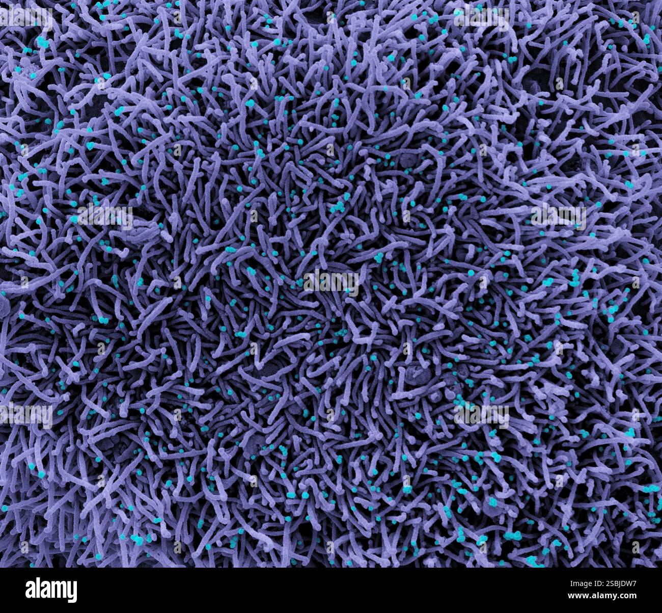 A CCL-81 cell (purple) infected with SARS-CoV-2 virus particles, which ...