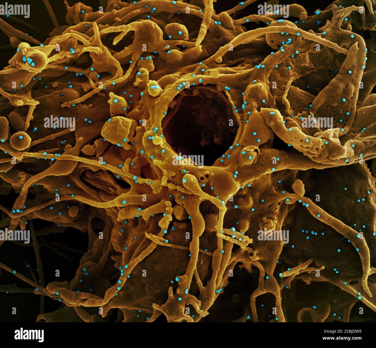 Colorized scanning electron micrograph of a cell (yellow infected with ...