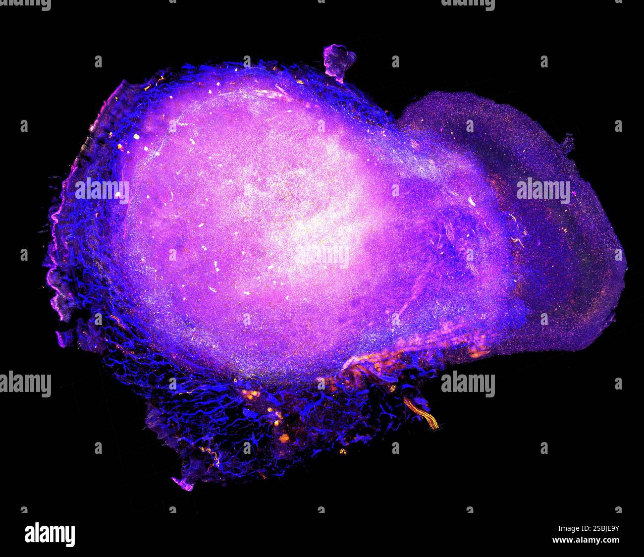 Using a novel imaging technique called transparent tumor tomography ...