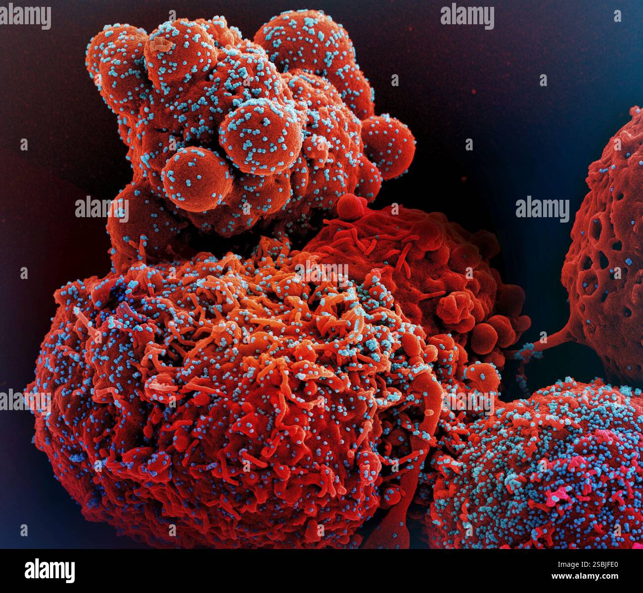 Colorized scanning electron micrograph of a cell (red) infected with ...