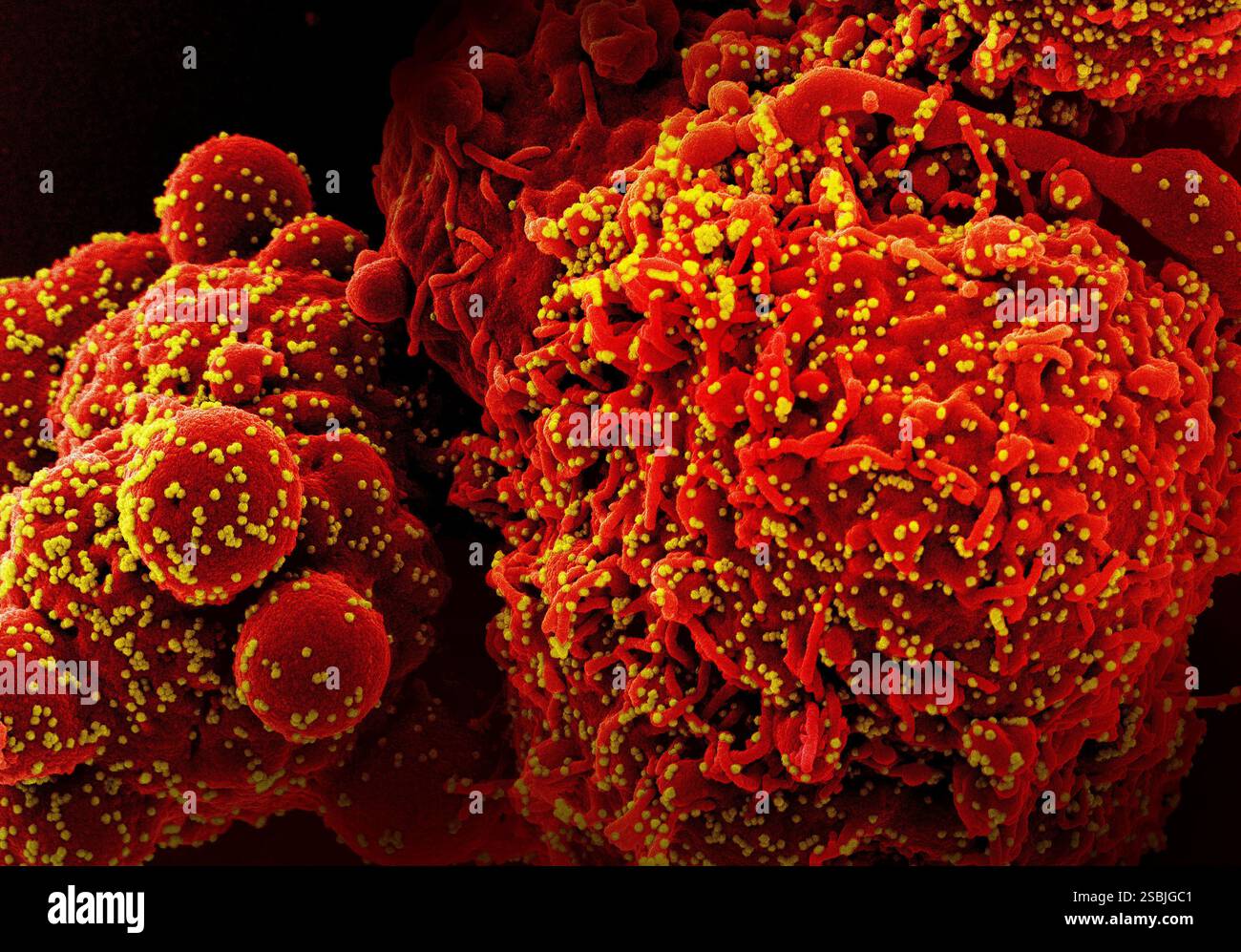 Colorized scanning electron micrograph of a cell (green) infected with ...
