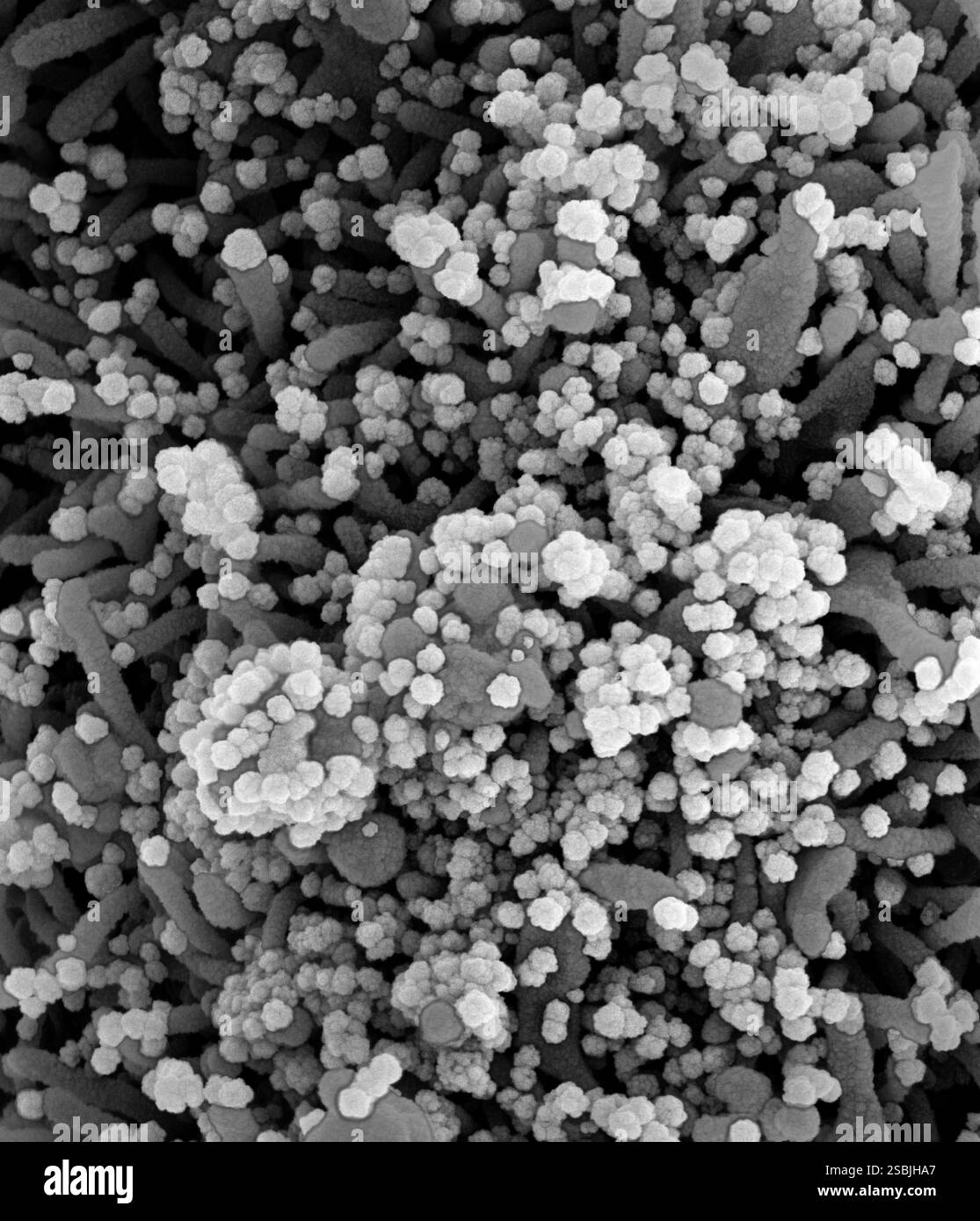 Scanning electron micrograph of a cell heavily infected with SARS-CoV-2 ...