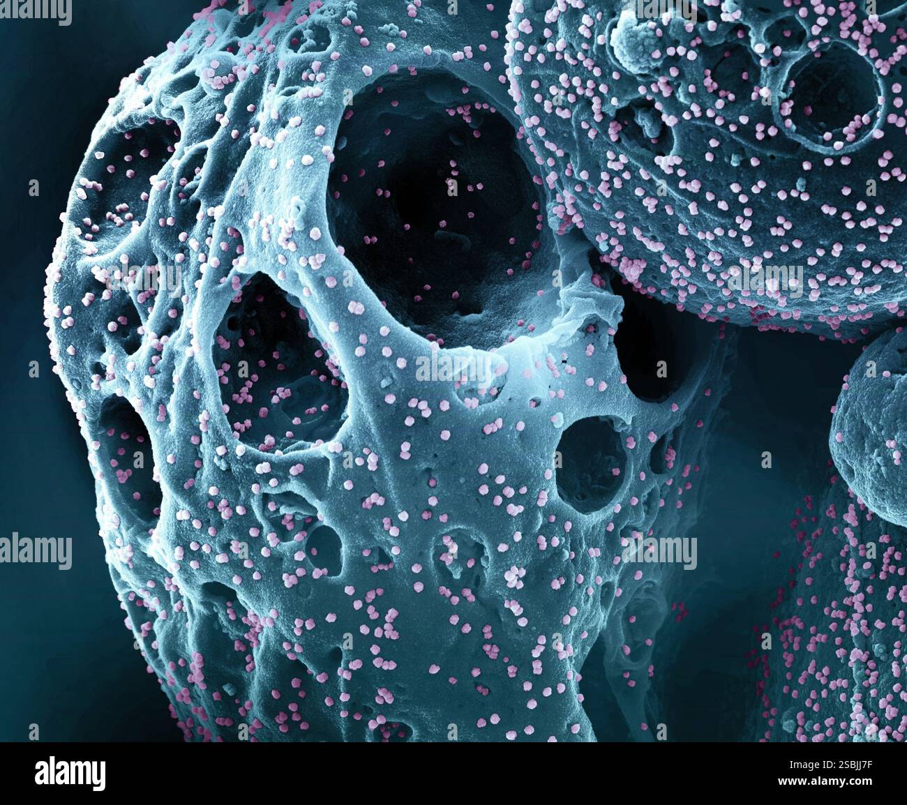 Colorized scanning electron micrograph of a cell (blue) infected with ...