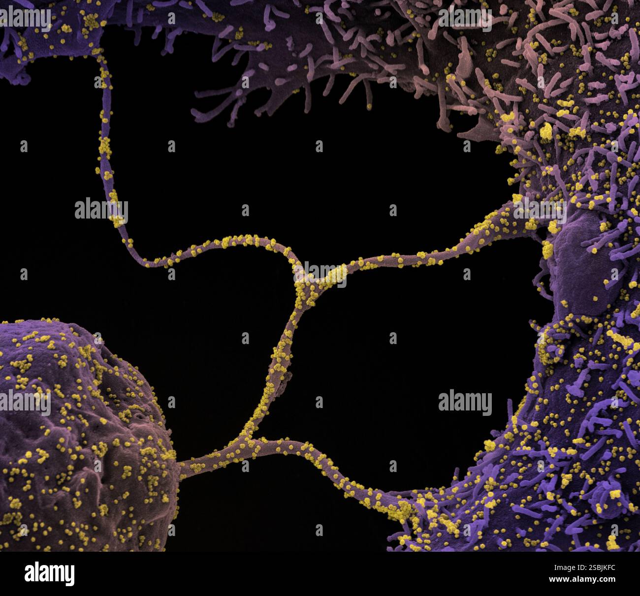 Colorized scanning electron micrograph of CCL-81 cells (purple ...