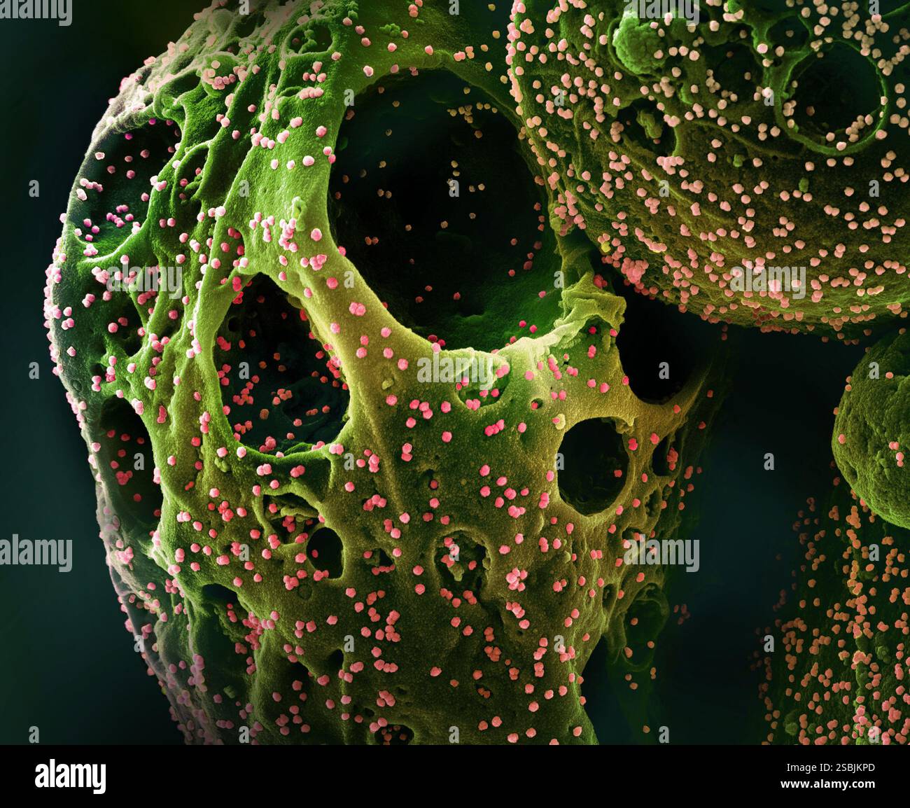 Colorized scanning electron micrograph of a cell (green) infected with ...