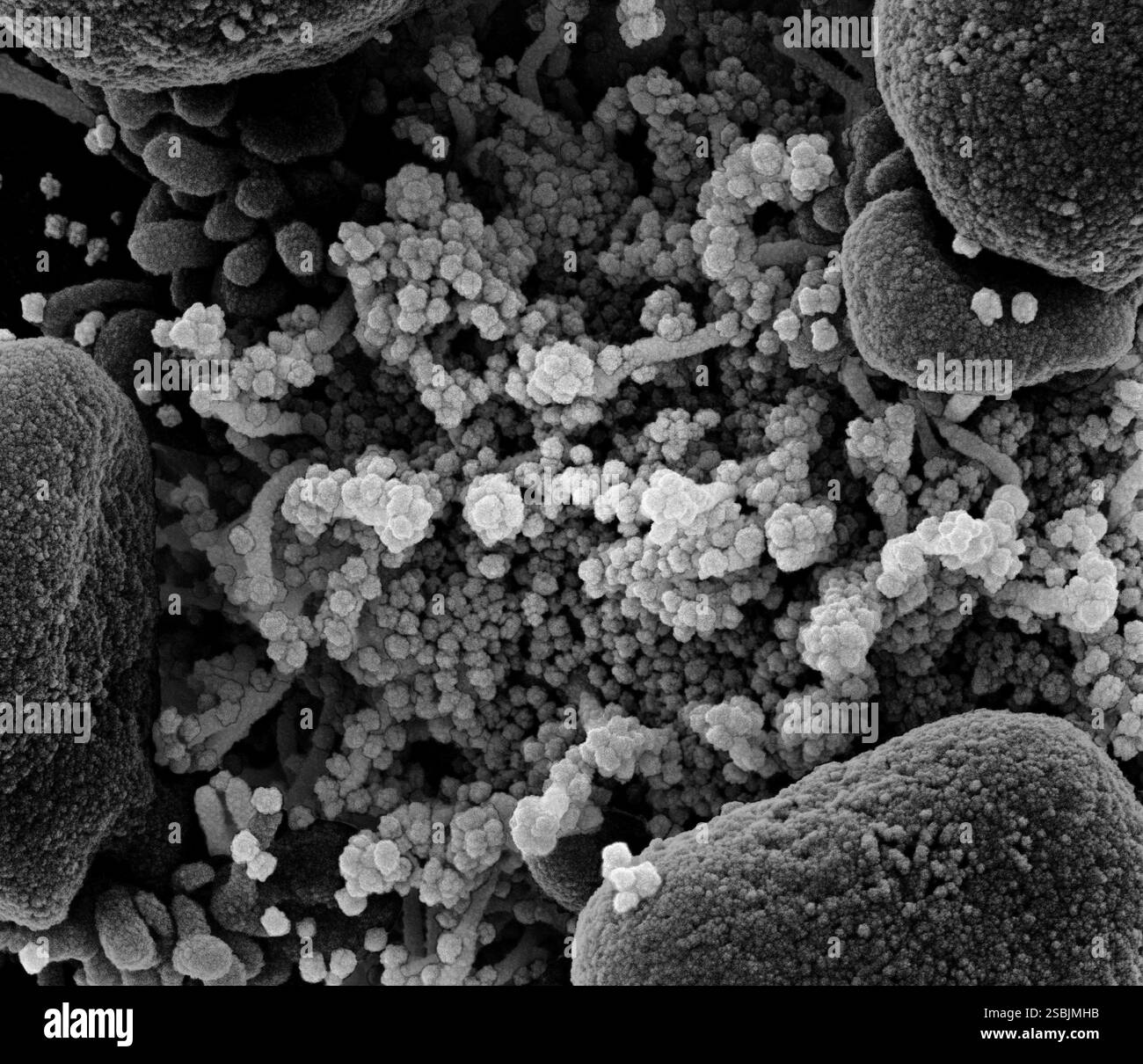 Scanning electron micrograph of an apoptotic cell heavily infected with ...