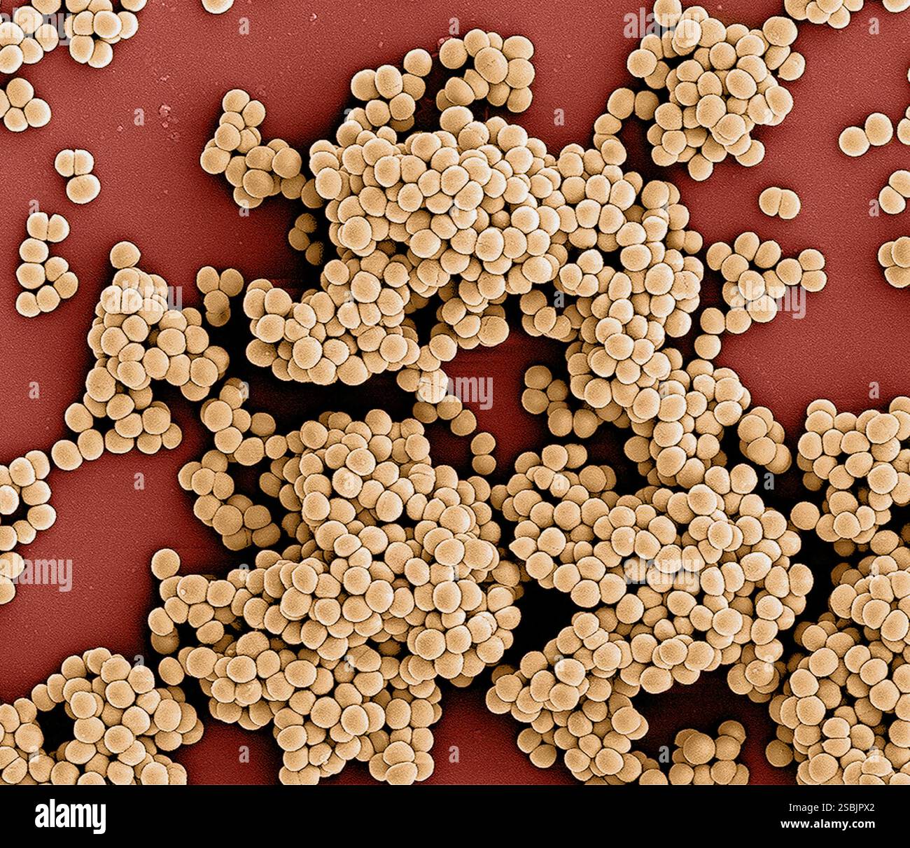 Colorized SEM of Methicillin-resistant Staphylococcus aureus (MRSA ...
