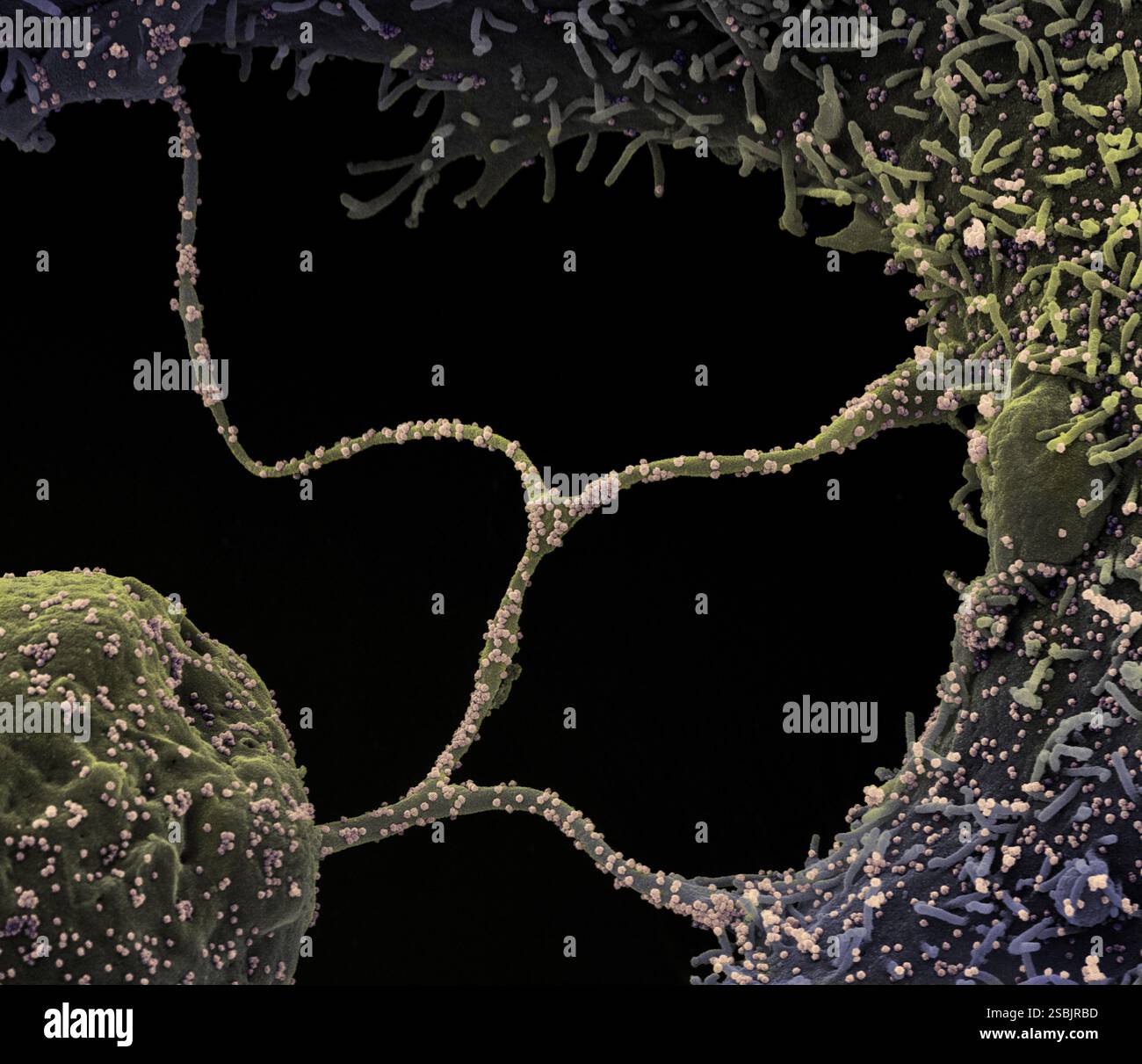 Colorized scanning electron micrograph of CCL-81 cells (green) infected ...
