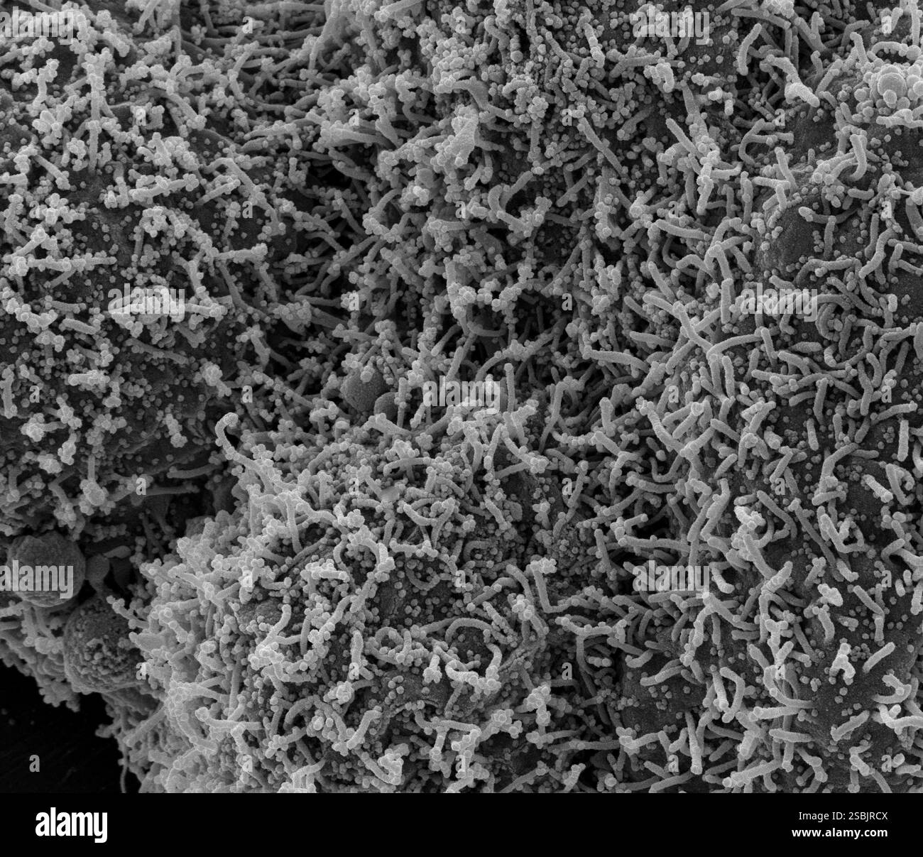 CCL-81 cells heavily infected with SARS-CoV-2 virus particles. The ...