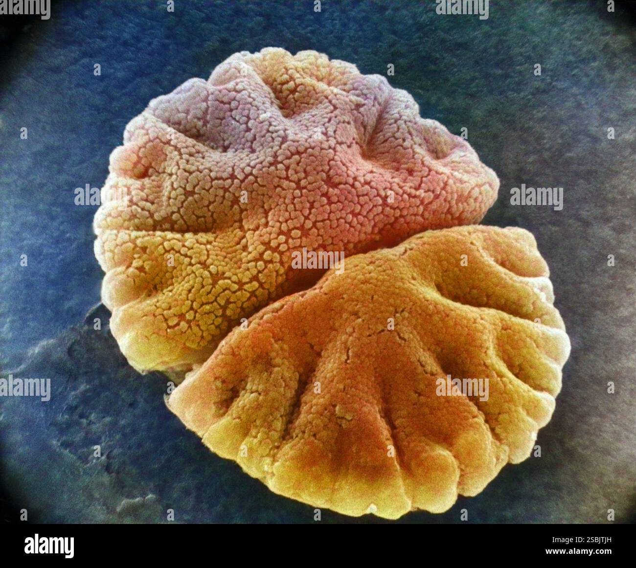 Scanning Electron Micrograph (SEM) of the desmid (green algae) species ...