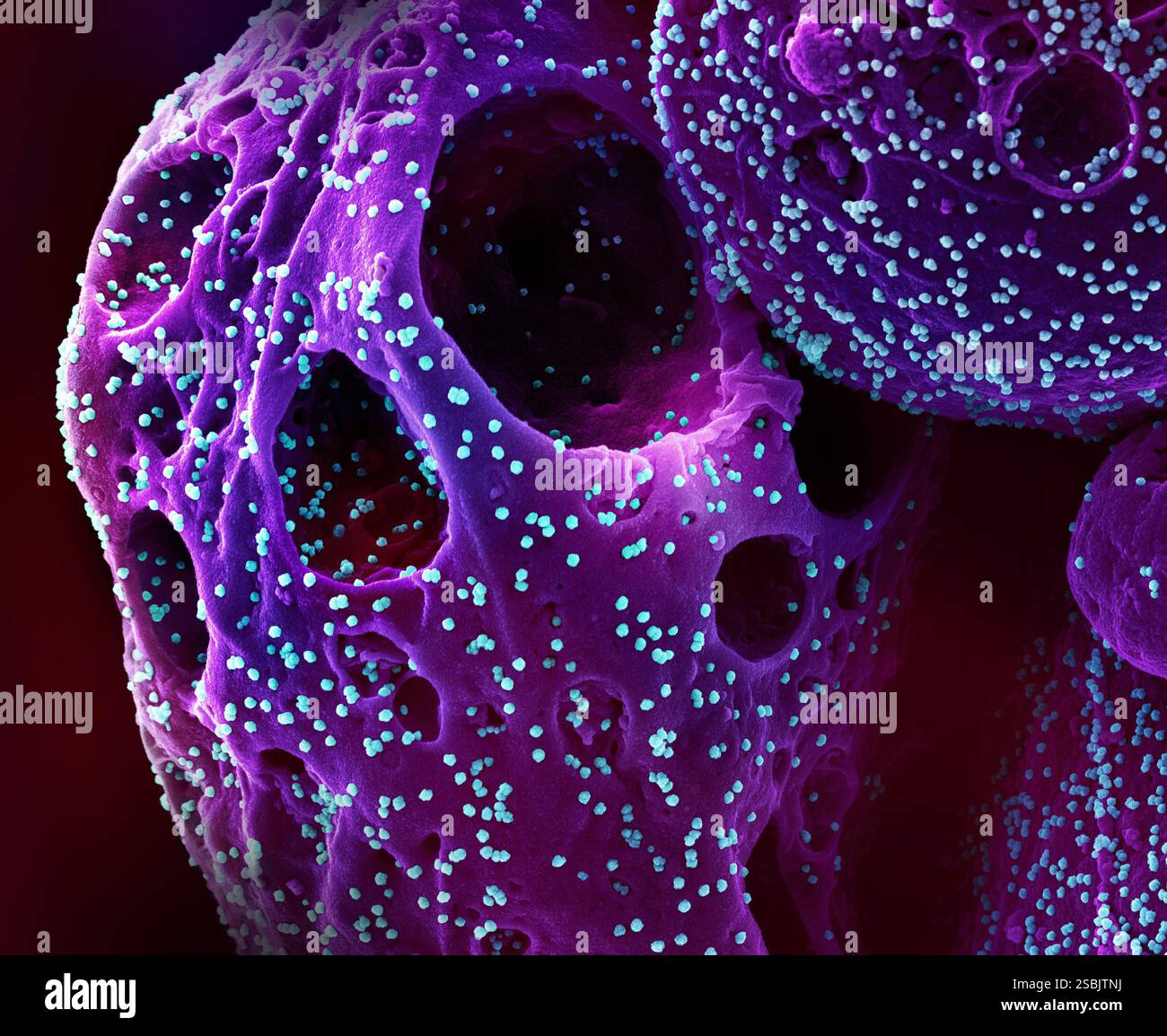 Colorized scanning electron micrograph of a cell (purple) infected with ...