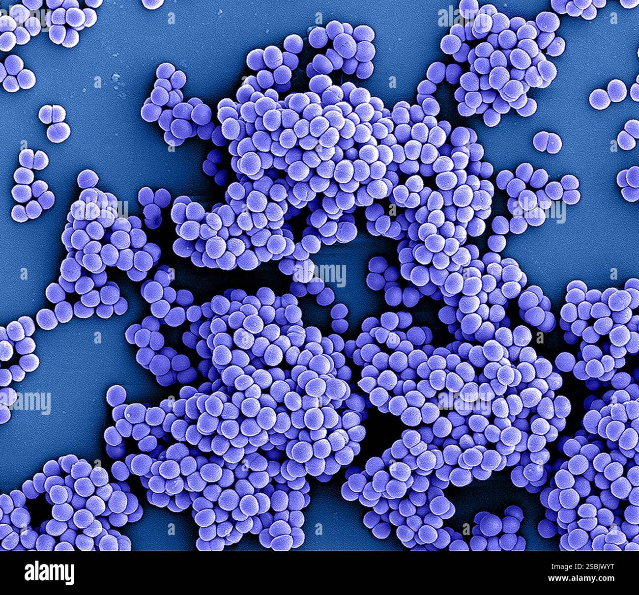 Colorized SEM of Methicillin-resistant Staphylococcus aureus (MRSA) bacteria Stock Photo - Alamy