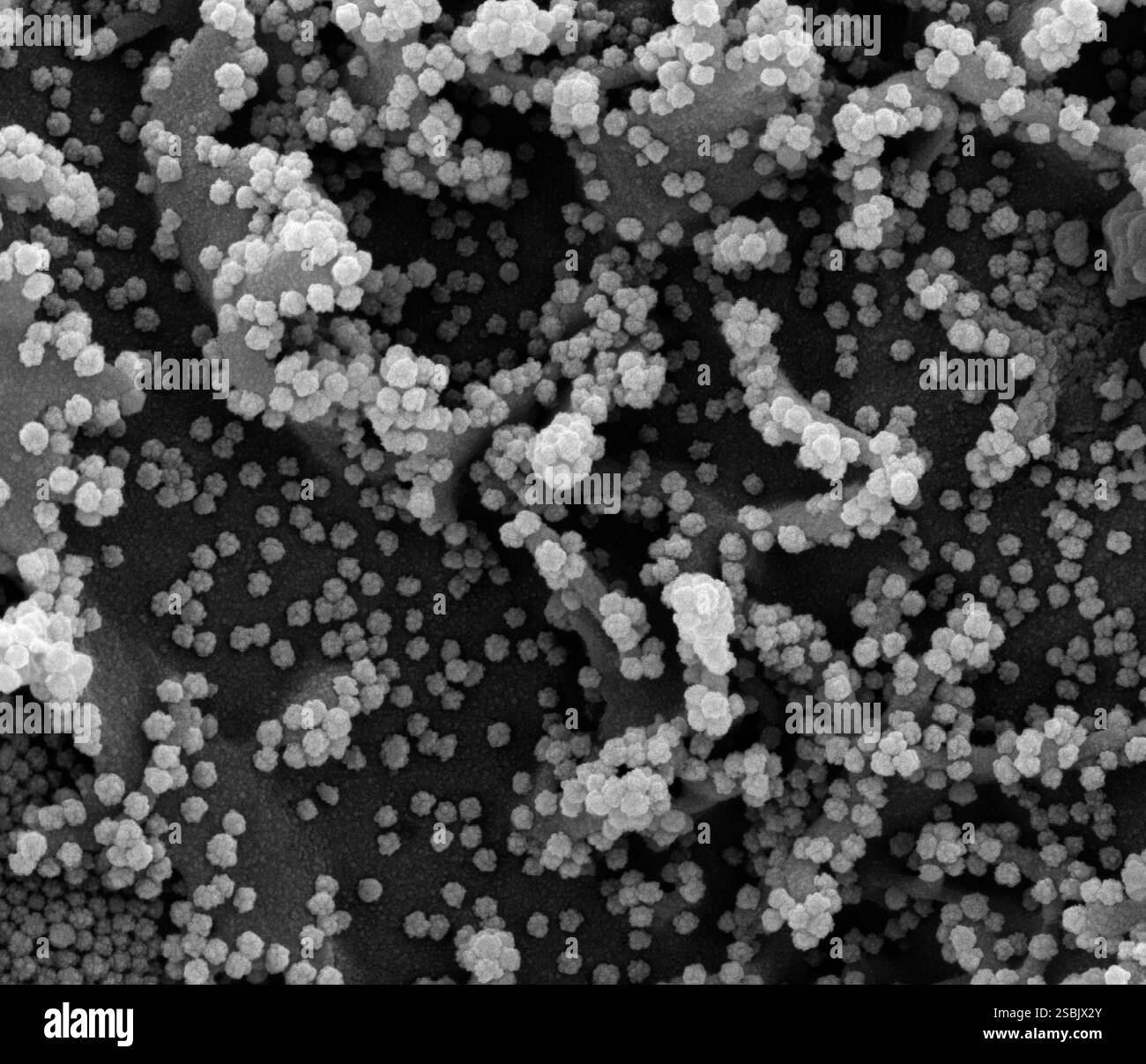 Scanning electron micrograph of a cell heavily infected with SARS-CoV-2 ...