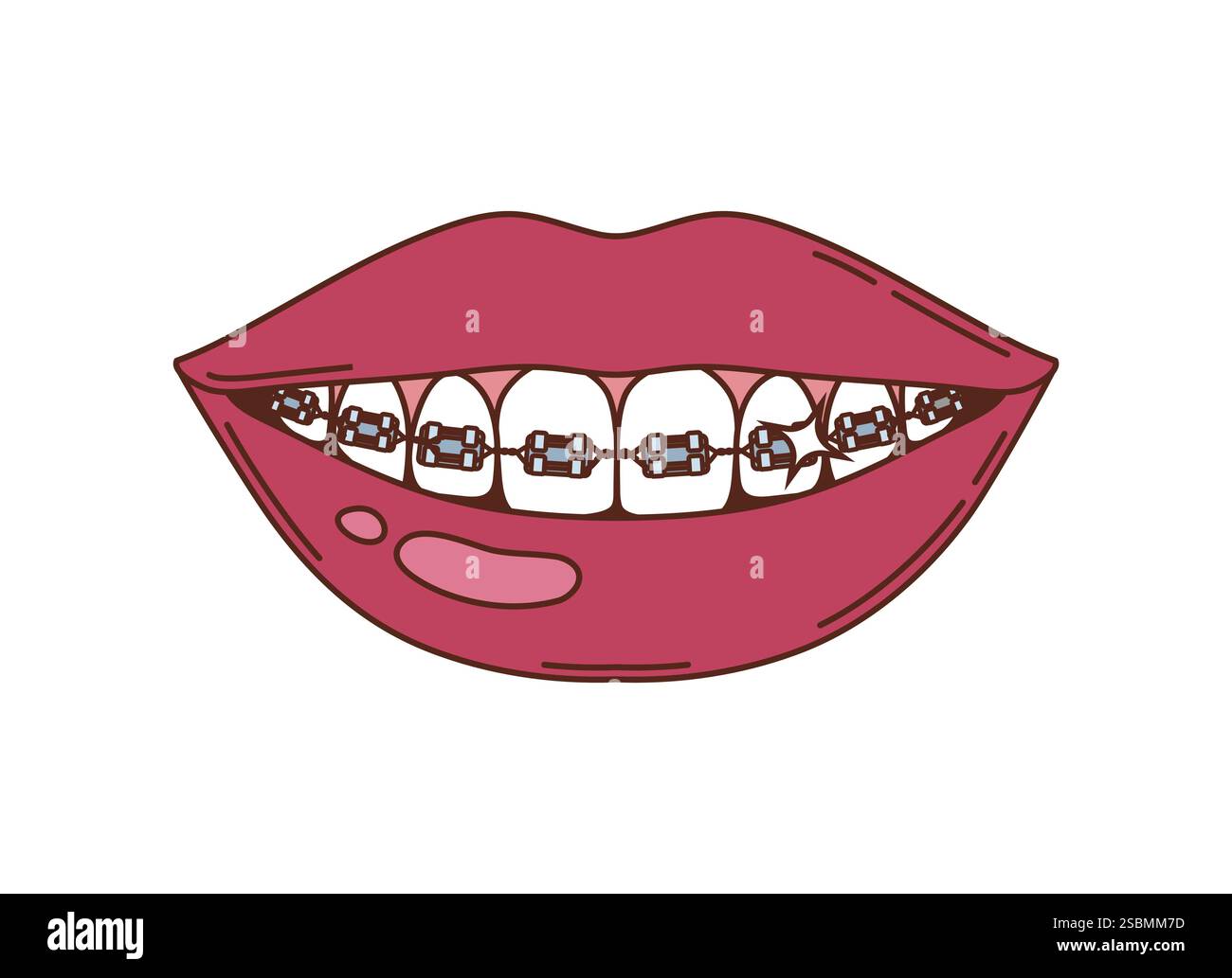 Cartoon groovy smiling lips revealing teeth with braces and wires ...