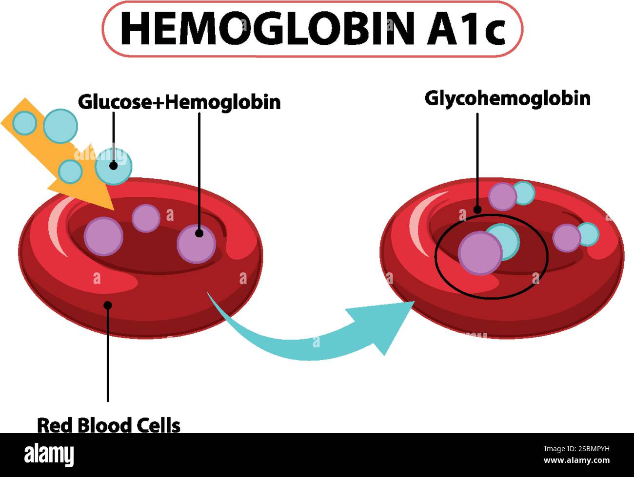 Illustration of glucose binding to hemoglobin Stock Vector Image & Art ...