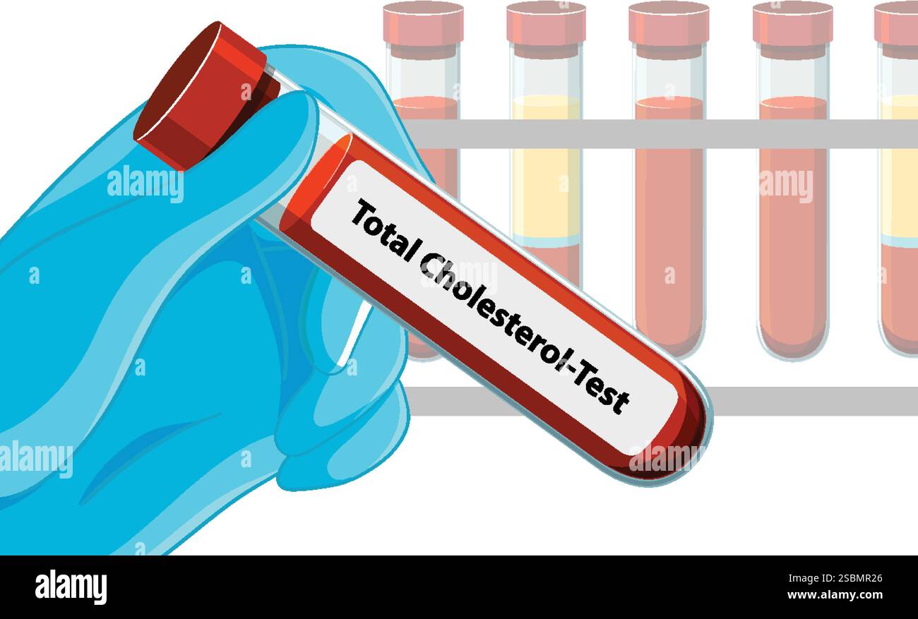 Hand holding a labeled blood test vial Stock Vector Image & Art - Alamy