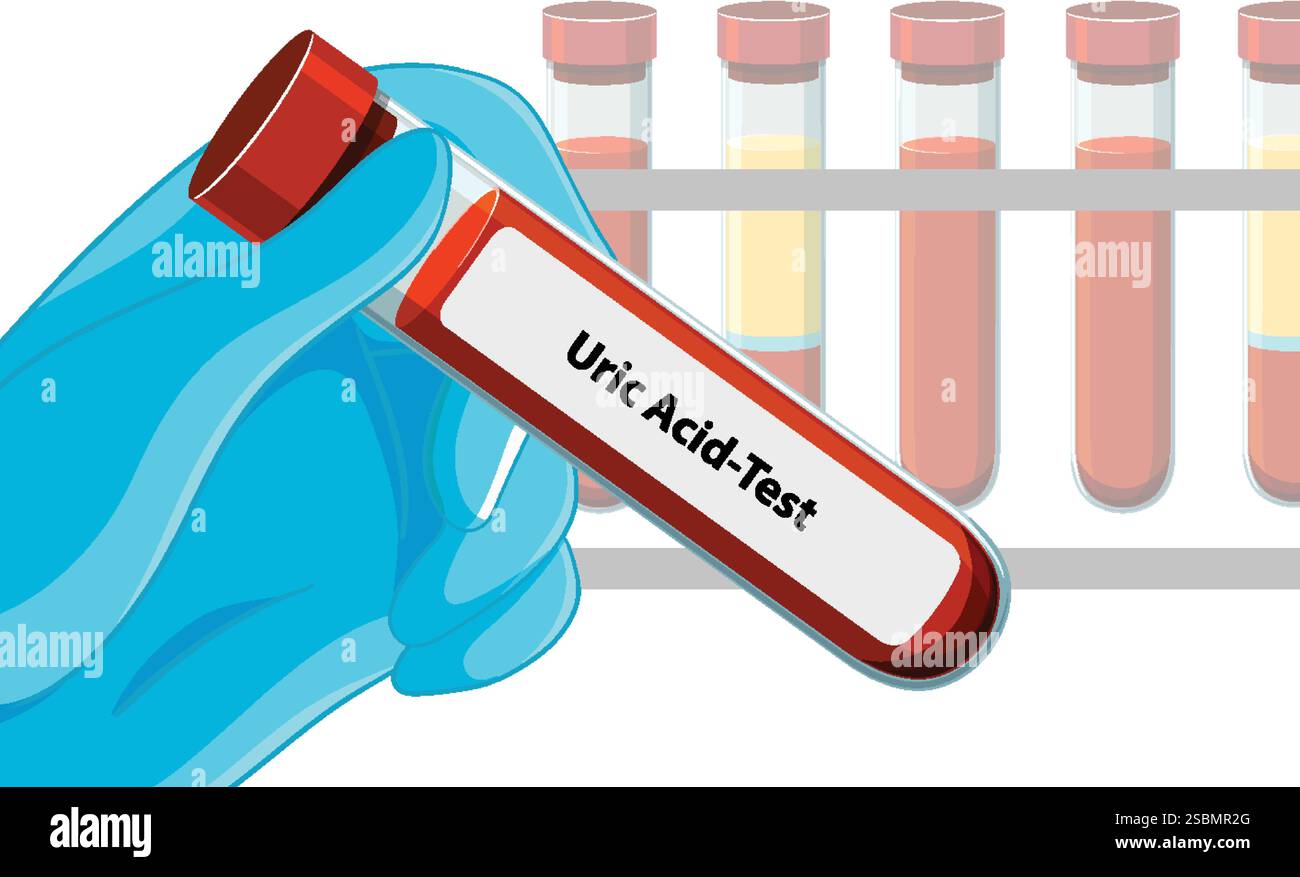 Illustration of a blood test for uric acid Stock Vector Image & Art - Alamy