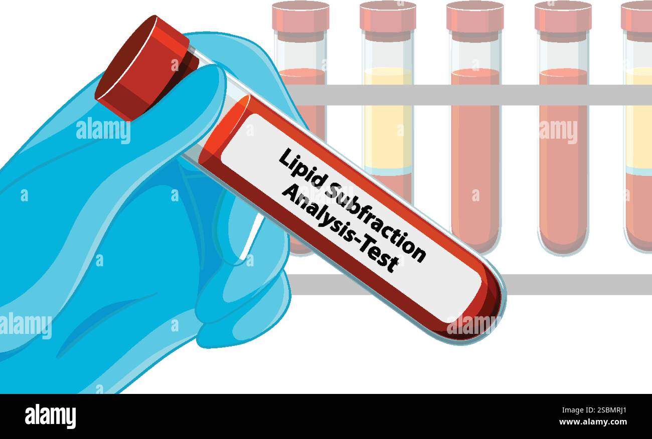 Hand holding test tube for lipid analysis Stock Vector Image & Art - Alamy