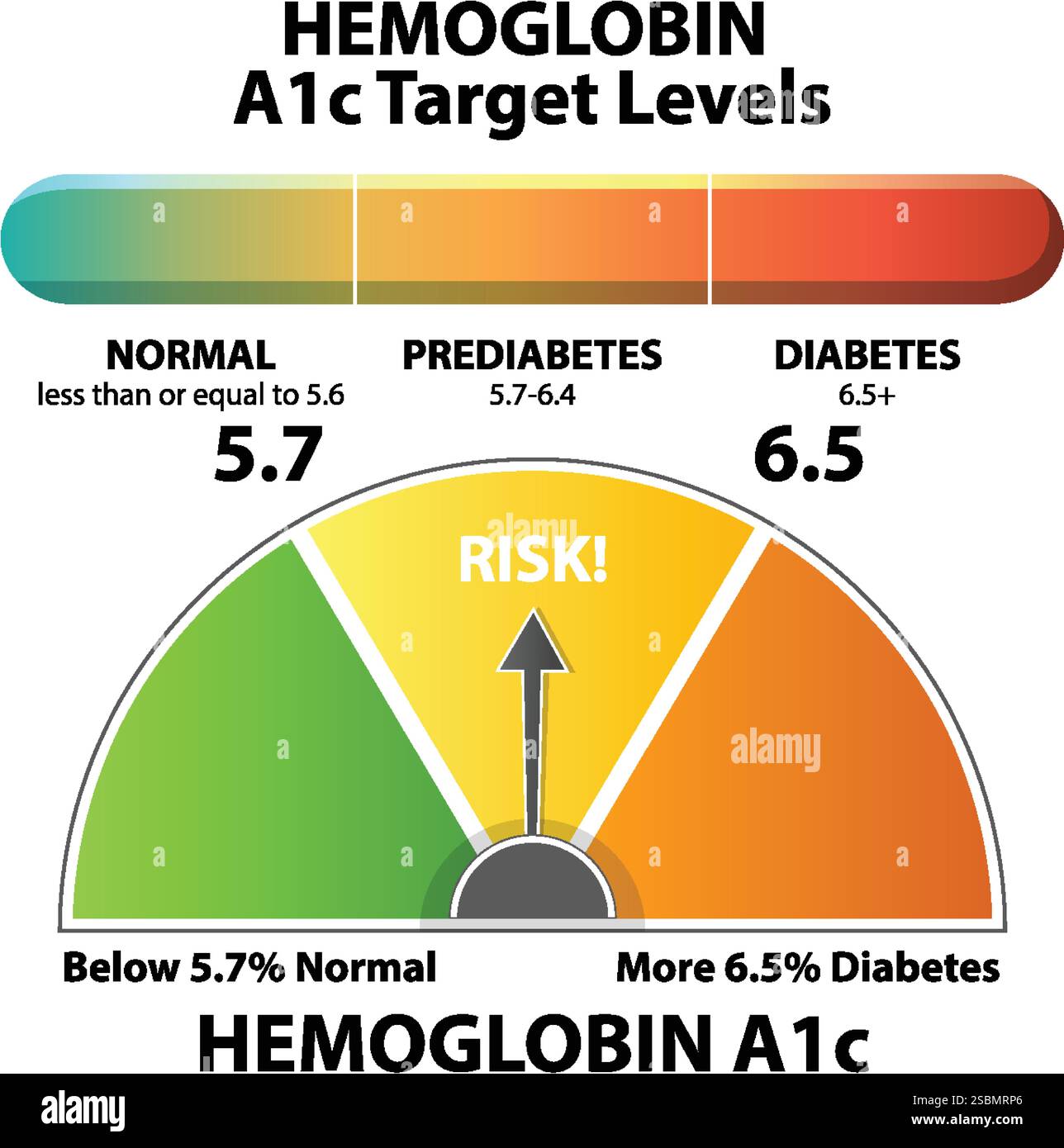 Visual guide to normal, prediabetes, and diabetes levels Stock Vector ...
