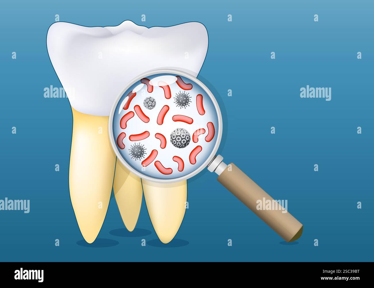 Bacteria in tooth cavity Stock Vector Images - Alamy