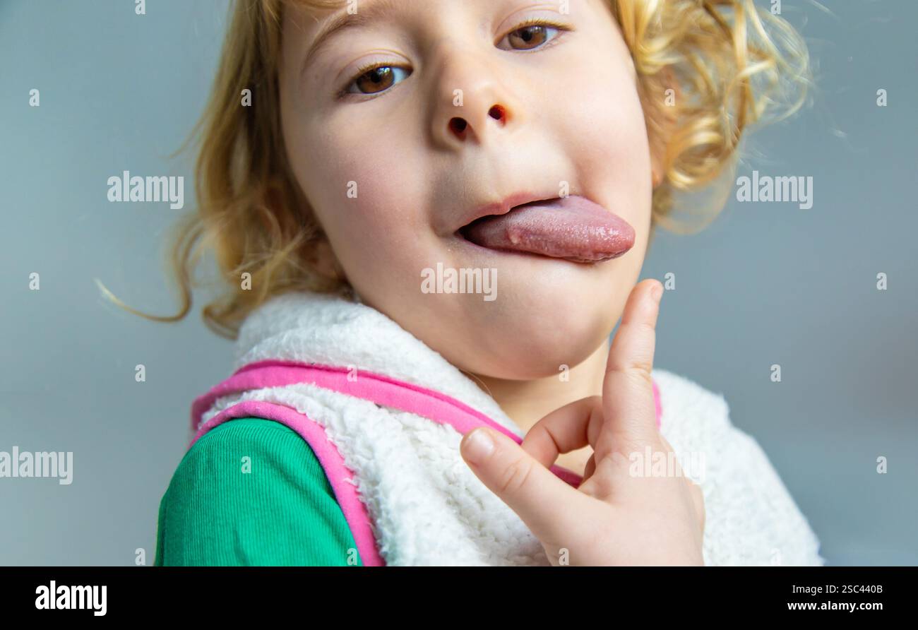The child bit the tongue of the wound. Selective focus Stock Photo - Alamy