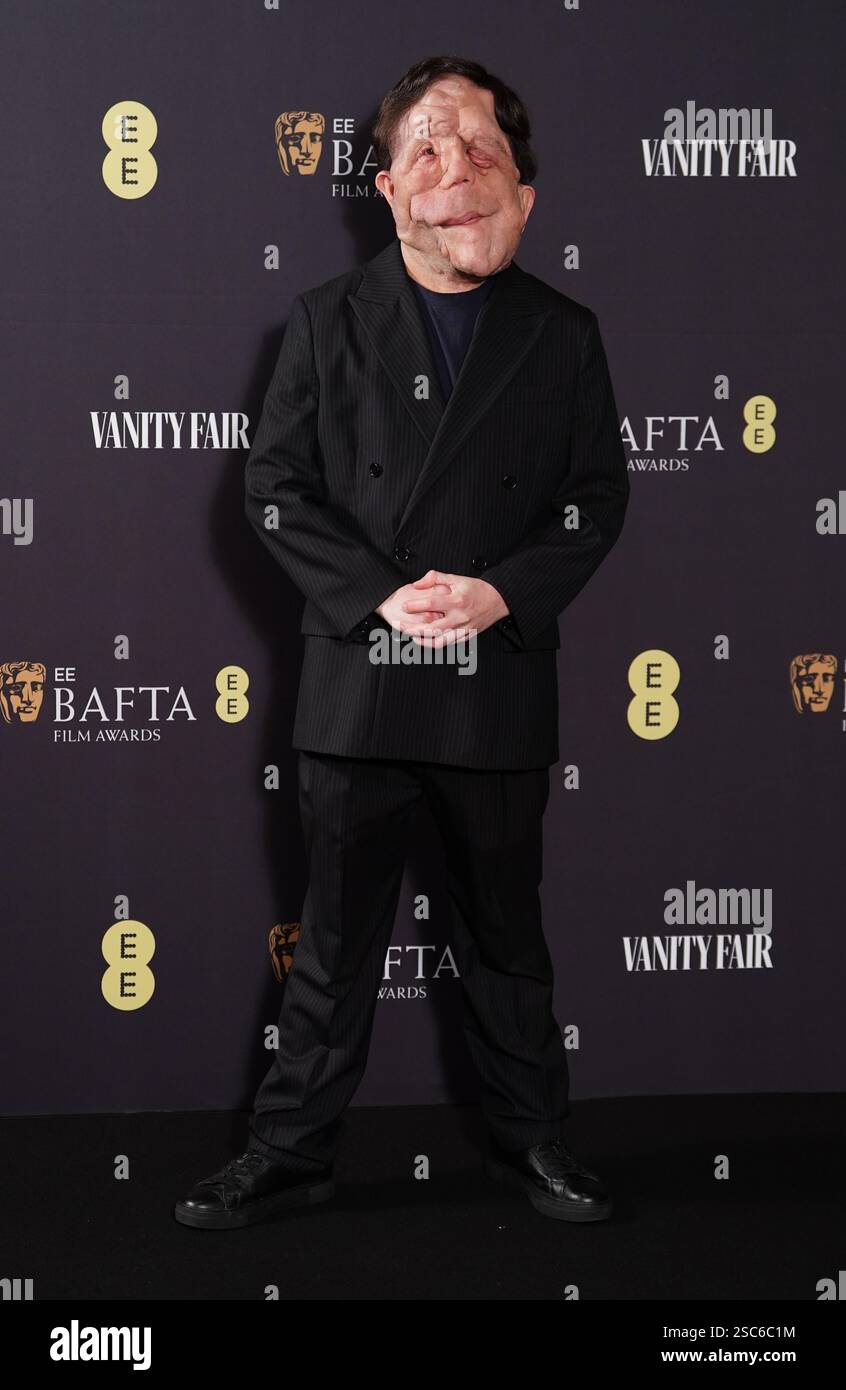 Adam Pearson attending the Vanity Fair EE Rising Star party ...