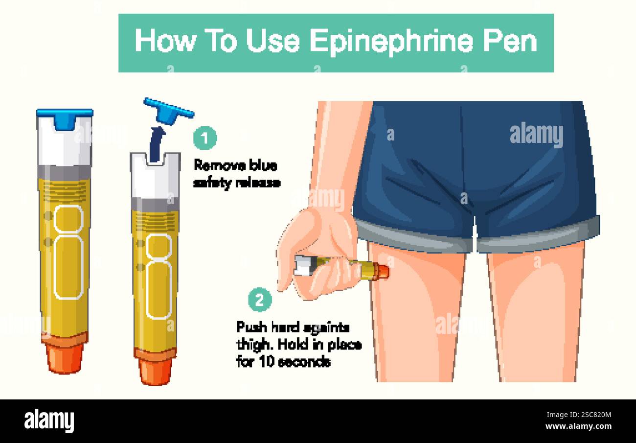 Step-by-step instructions for epinephrine pen use Stock Vector Image ...