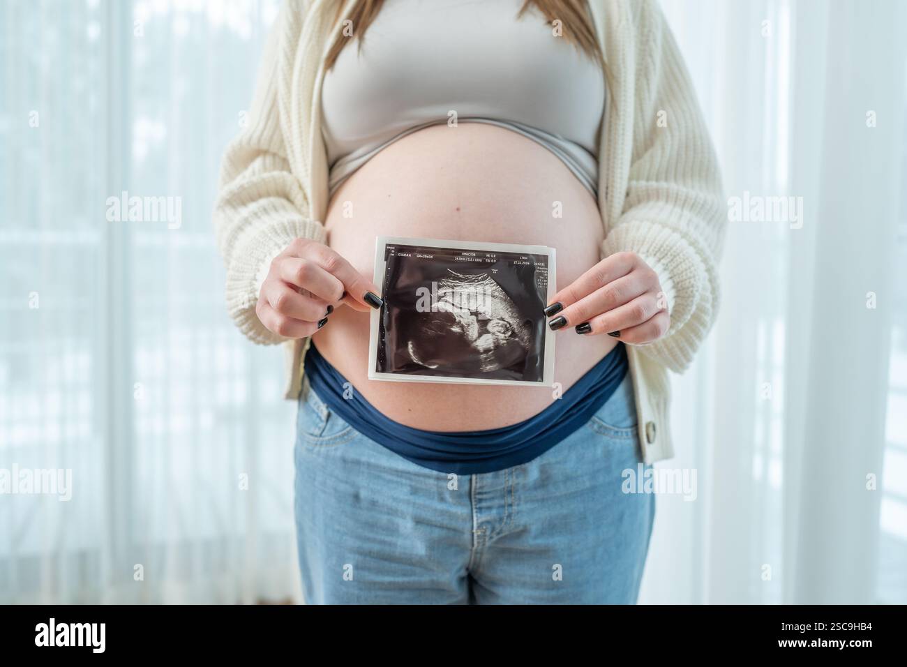 Young pregnant woman holding ultrasound scan photo of a fetus in front ...