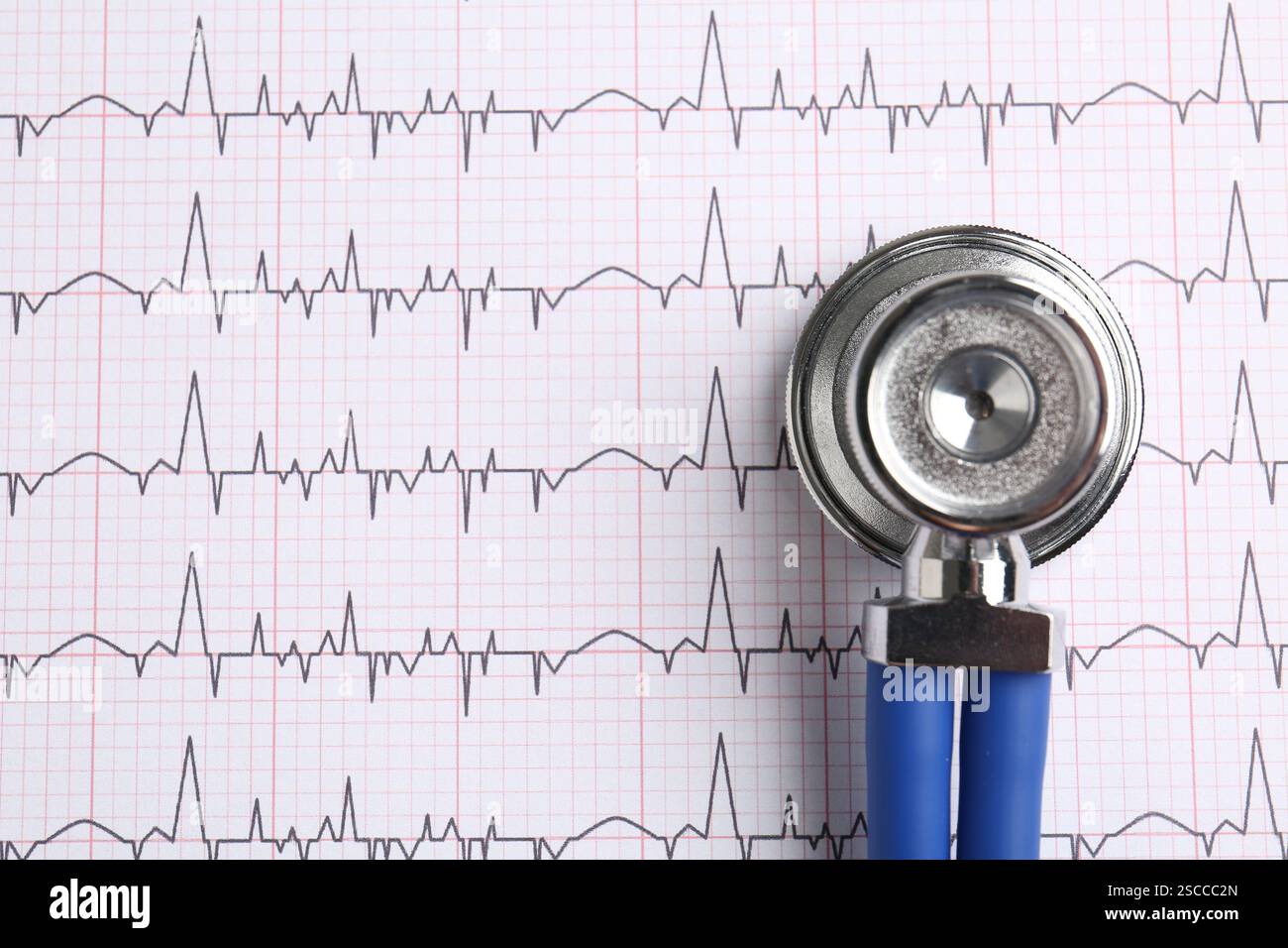 Cardiology. Stethoscope on paper with cardiogram, top view. Space for ...