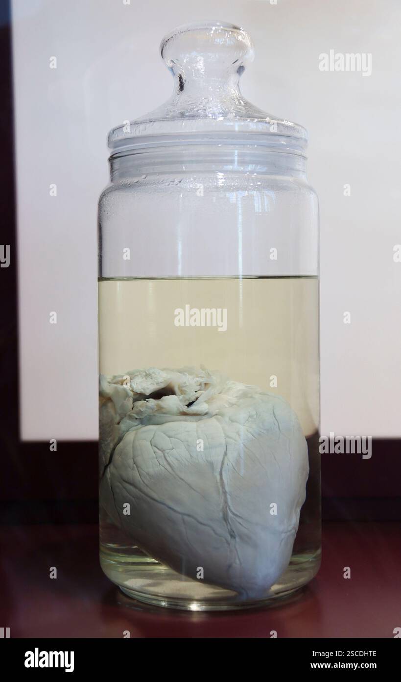 Beef heart preserved in formalin in a recipient in a laboratory Stock ...