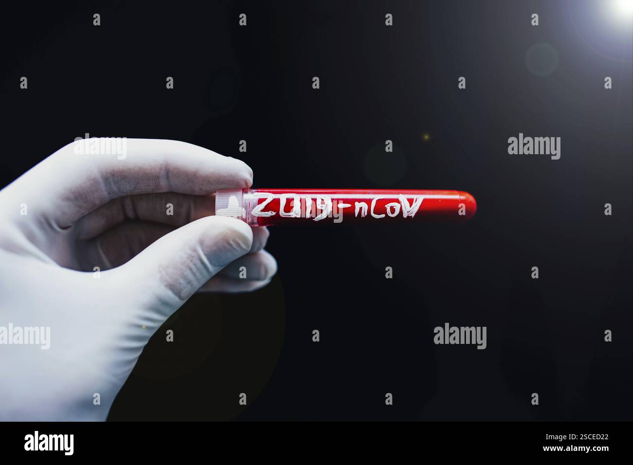 Hand holding a horizontally labeled test tube 2019-nCoV against a dark ...