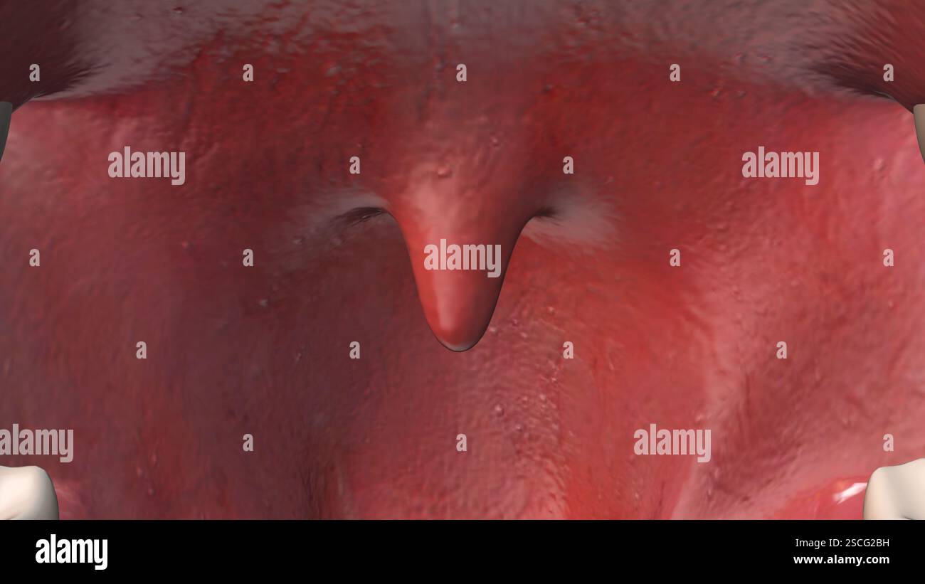 Close-Up of Uvula Inside Mouth Stock Photo - Alamy