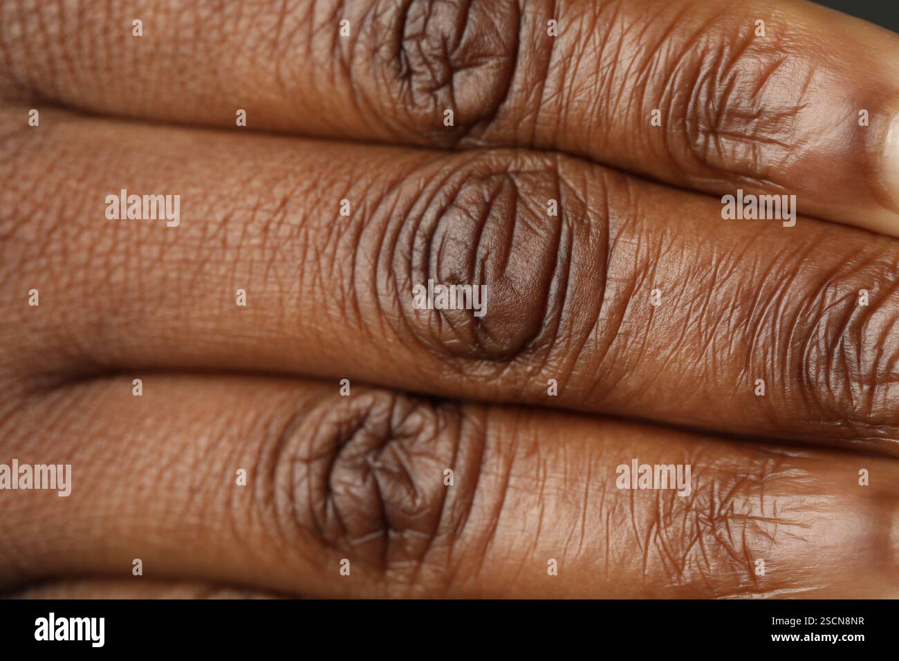 Macro view of normal skin as background Stock Photo - Alamy
