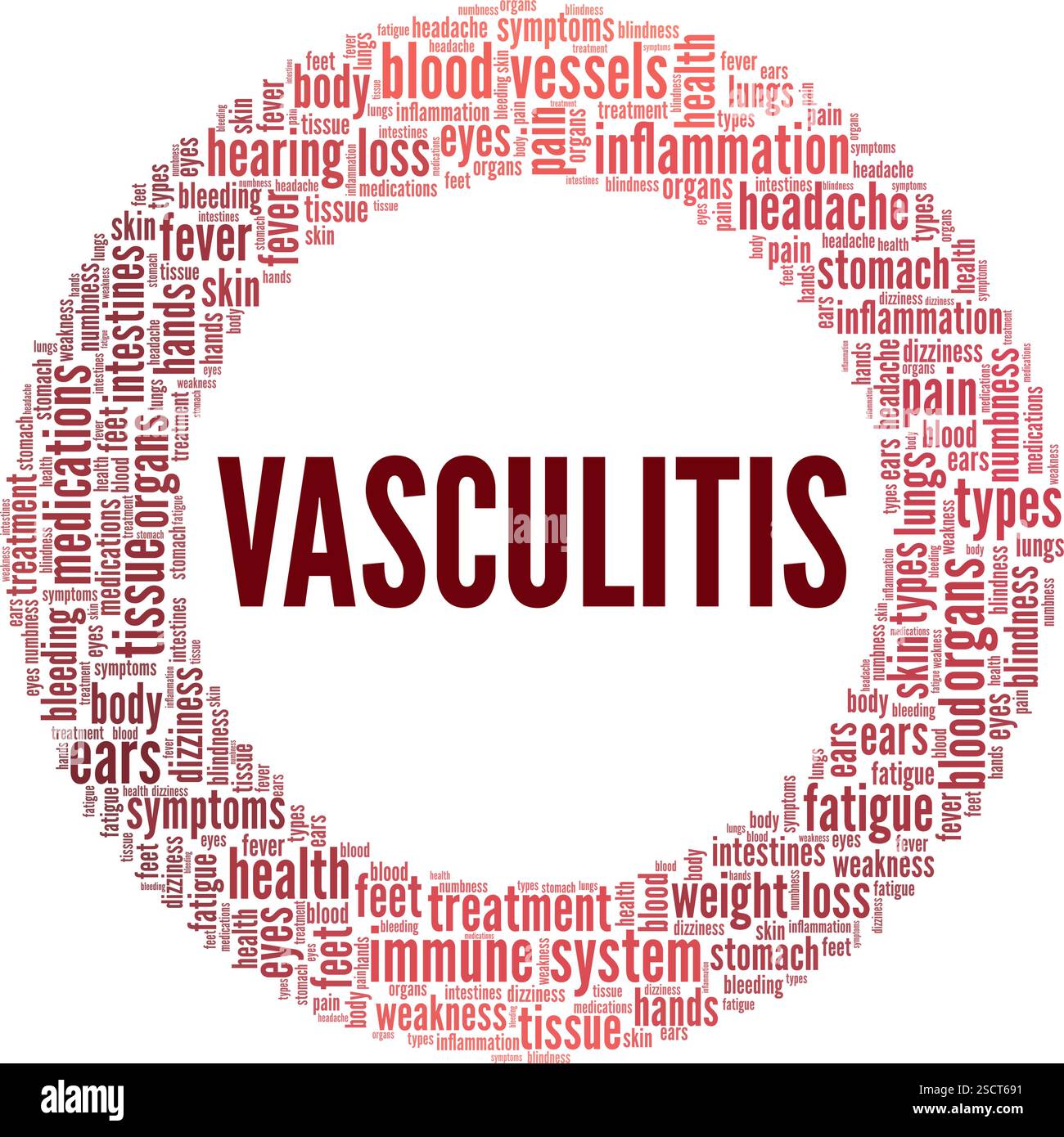 Vasculitis word cloud conceptual design isolated on white background ...